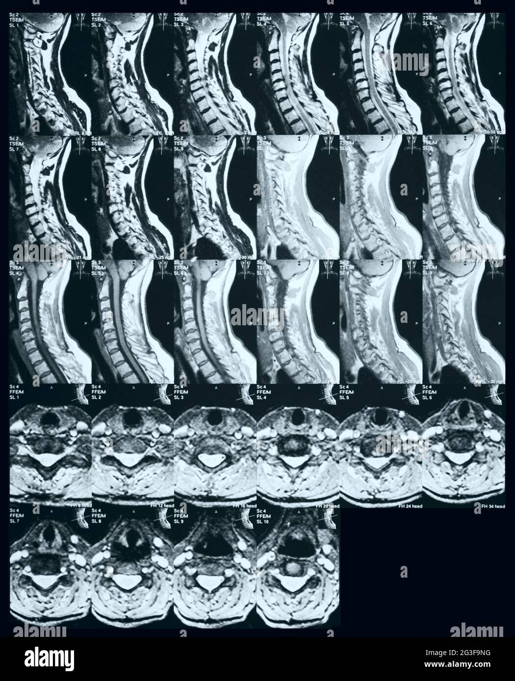 Mrt image hi-res stock photography and images - Alamy