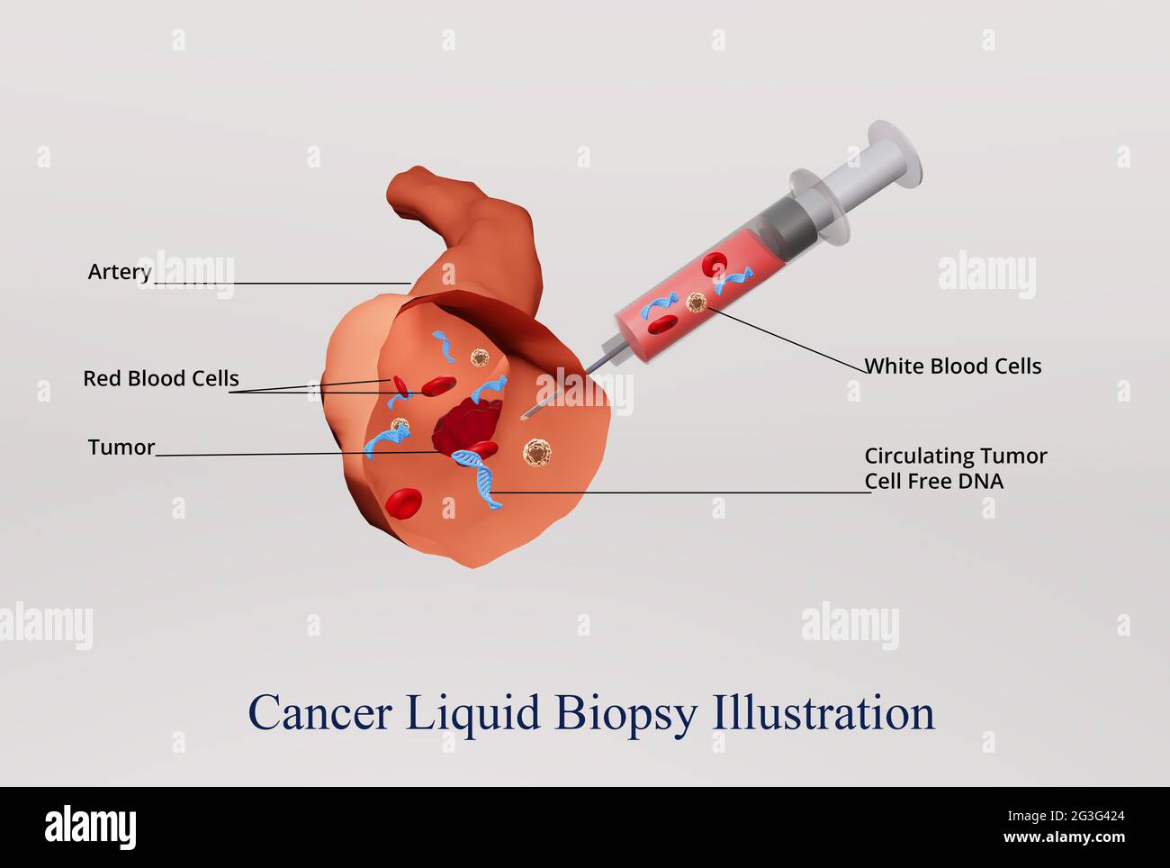 Circulating tumor cell hi-res stock photography and images - Alamy