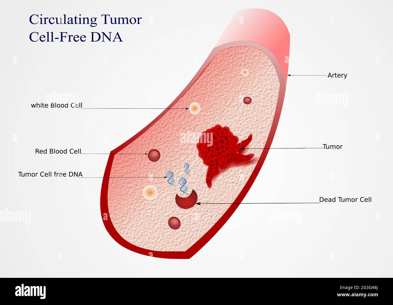 2D Diagram of Tumour Cell Free DNA in a blood artery released from a ...