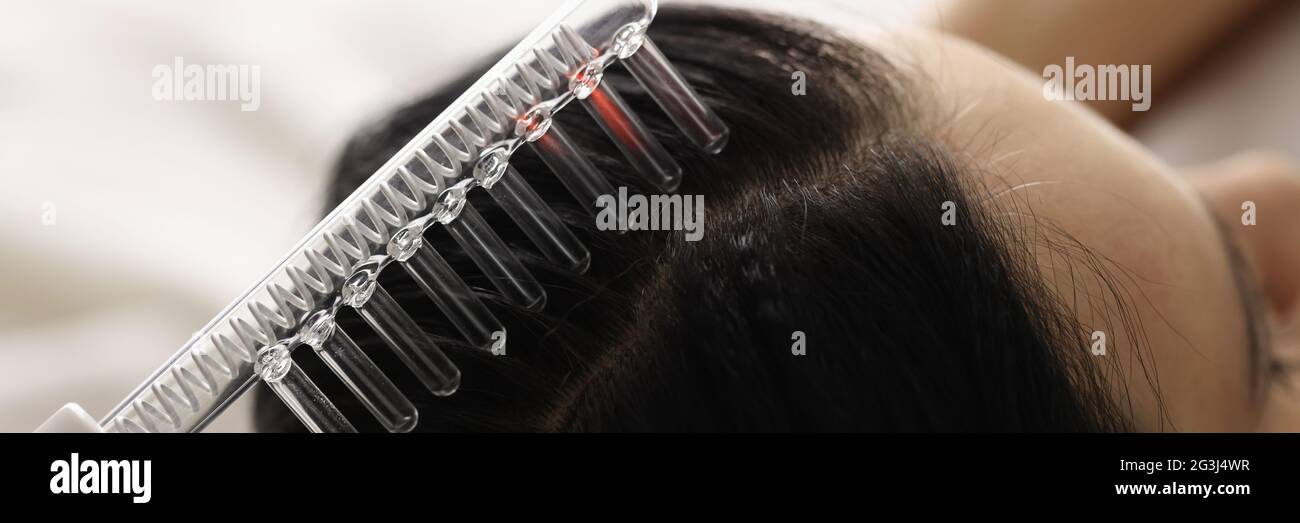 On female hair there is device for restoration of hair follicles Stock ...