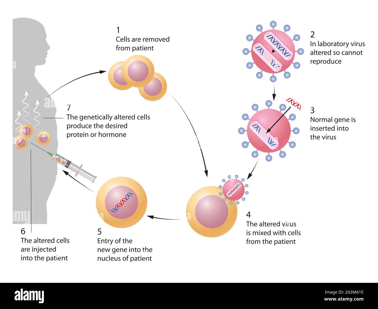 Gene therapy hi-res stock photography and images - Alamy