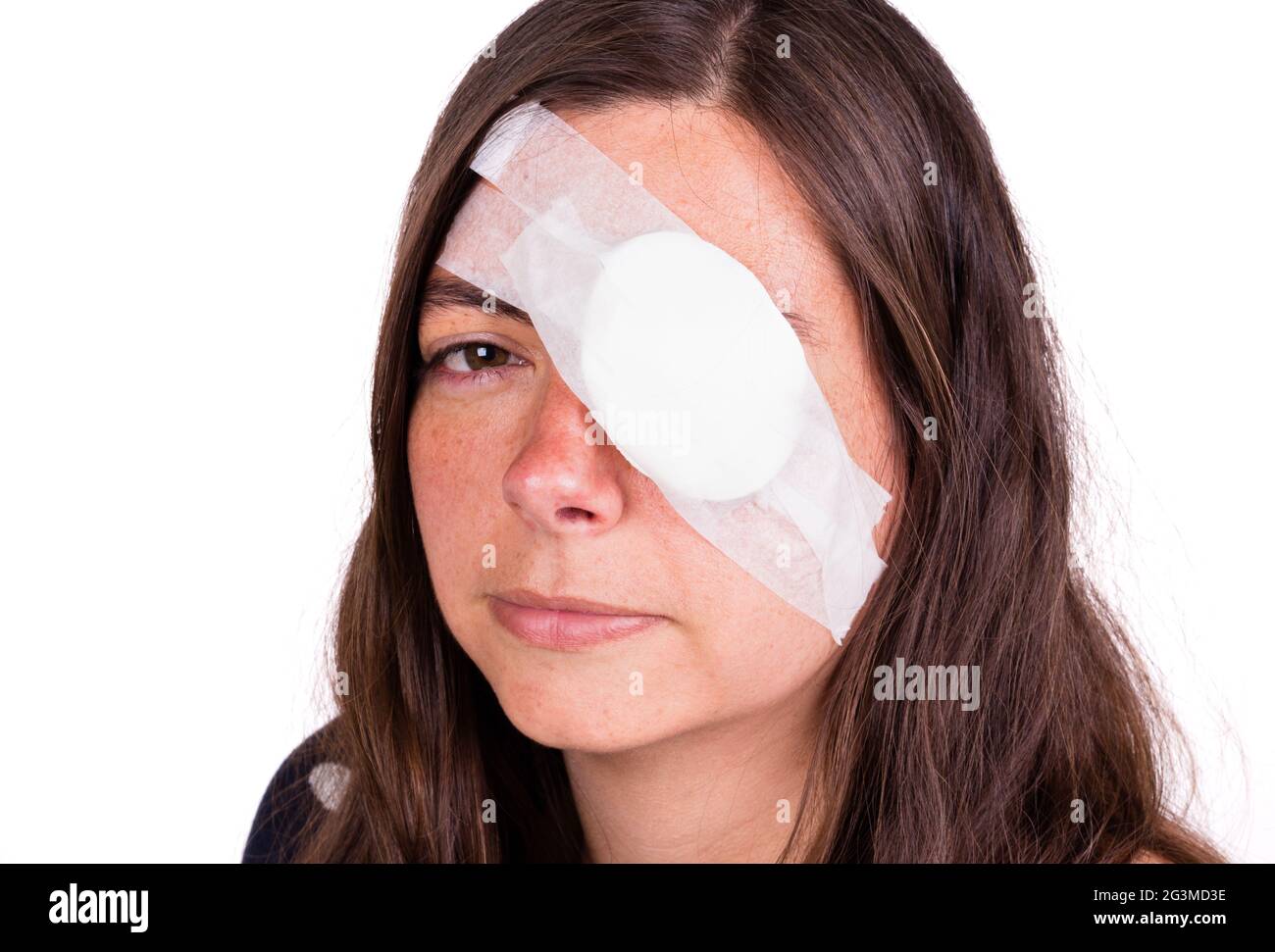 Portrait of woman wearing eye patch as protection after injury Stock ...