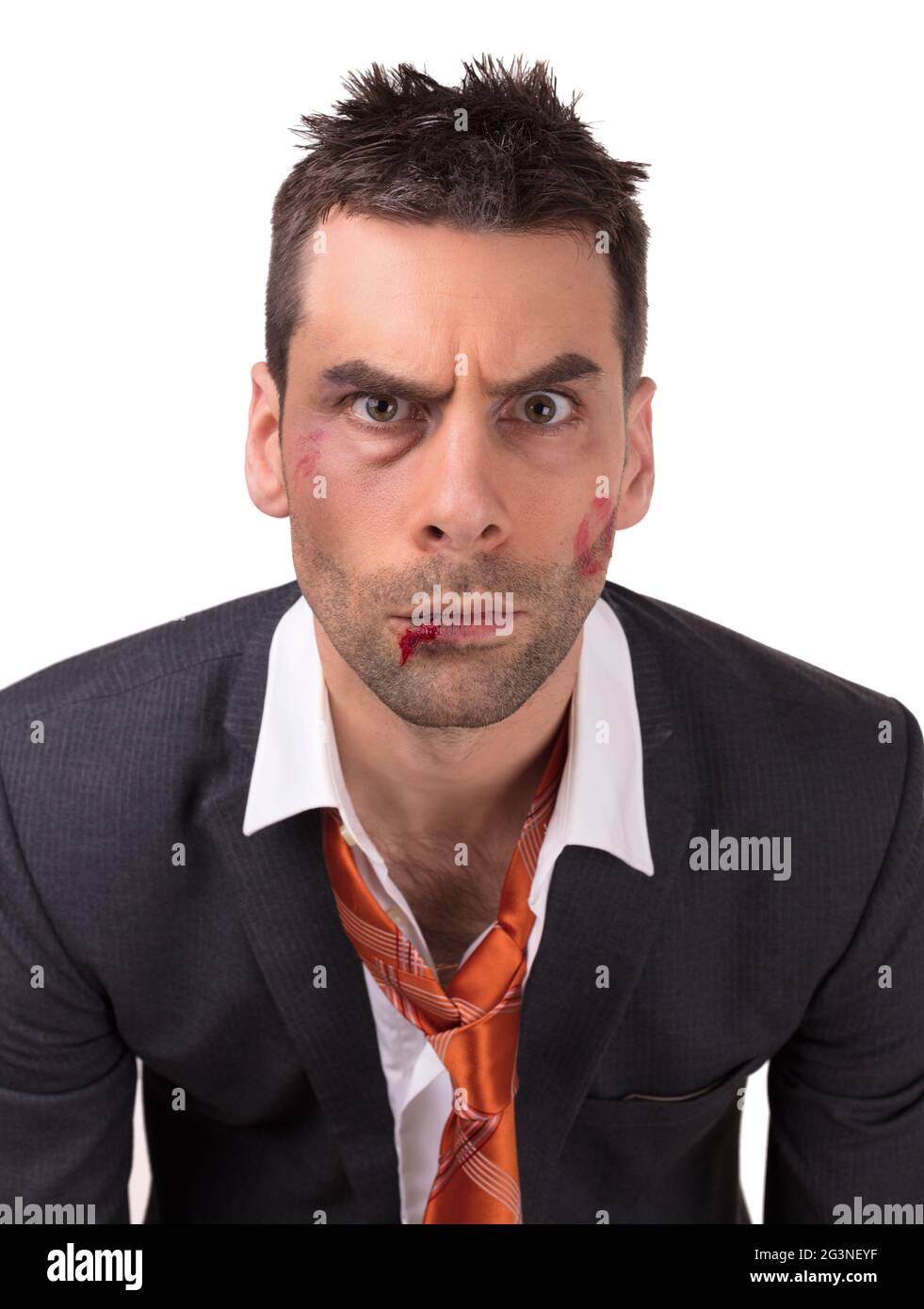 Bruised lips hi-res stock photography and images - Alamy