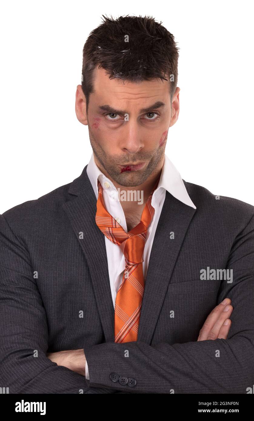 Bruised lips hi-res stock photography and images - Alamy