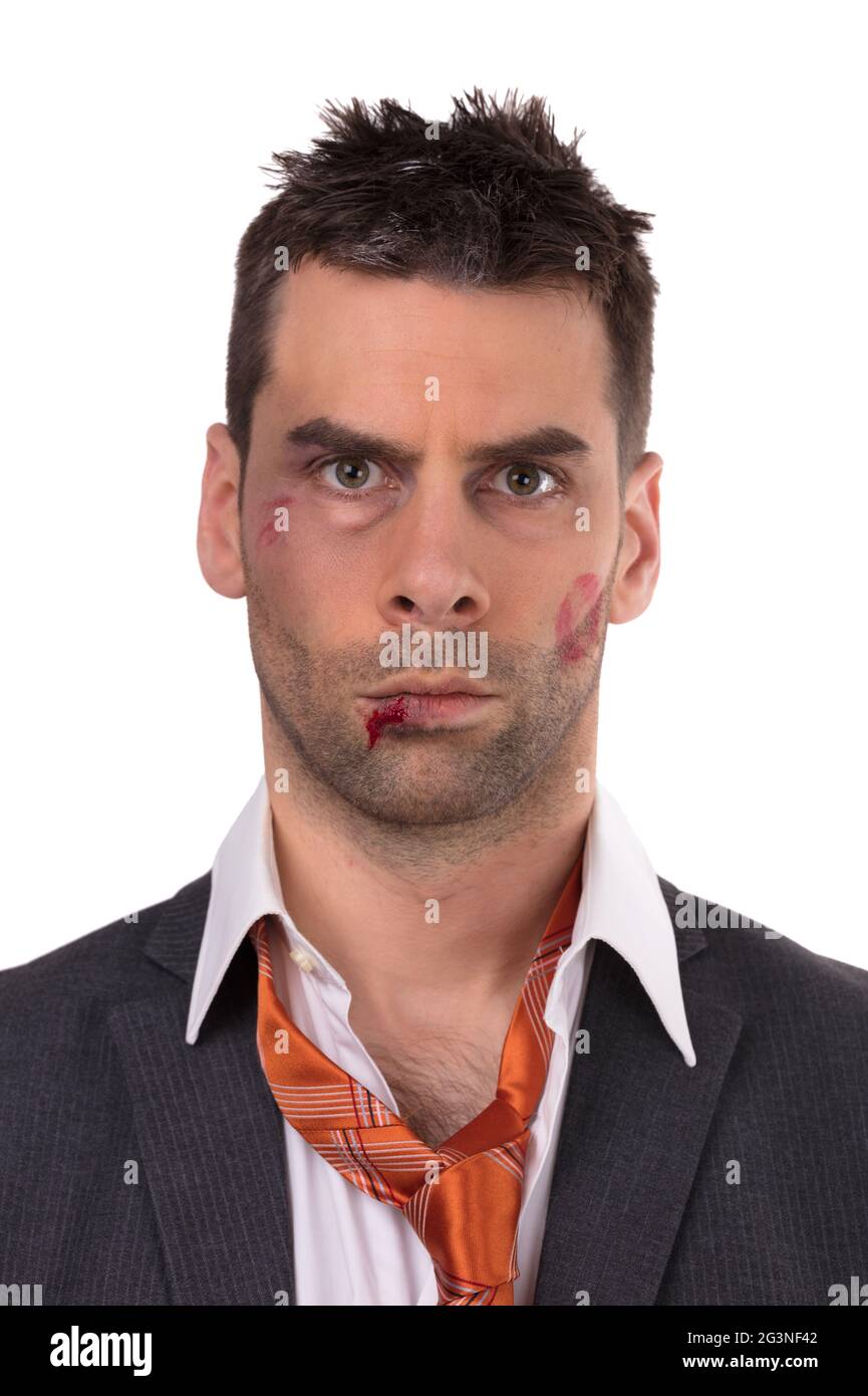 Man with bleeding lip hi-res stock photography and images - Alamy