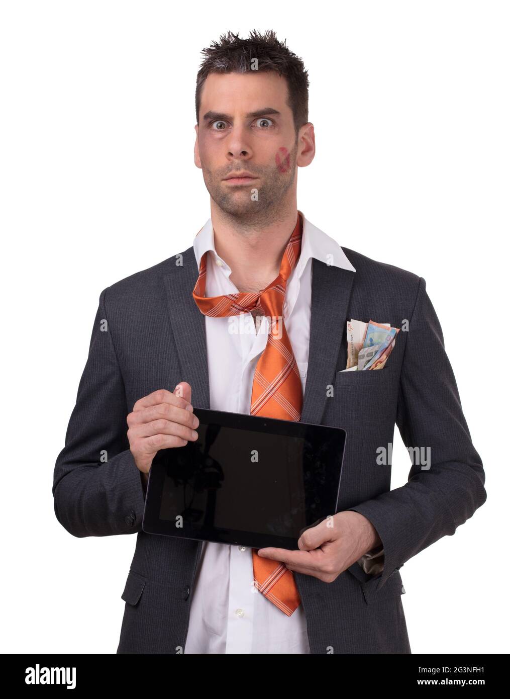 Bruised business man Stock Photo - Alamy