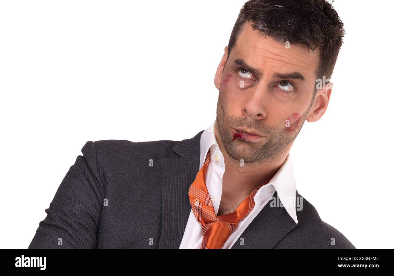 Man with bleeding lip hi-res stock photography and images - Alamy