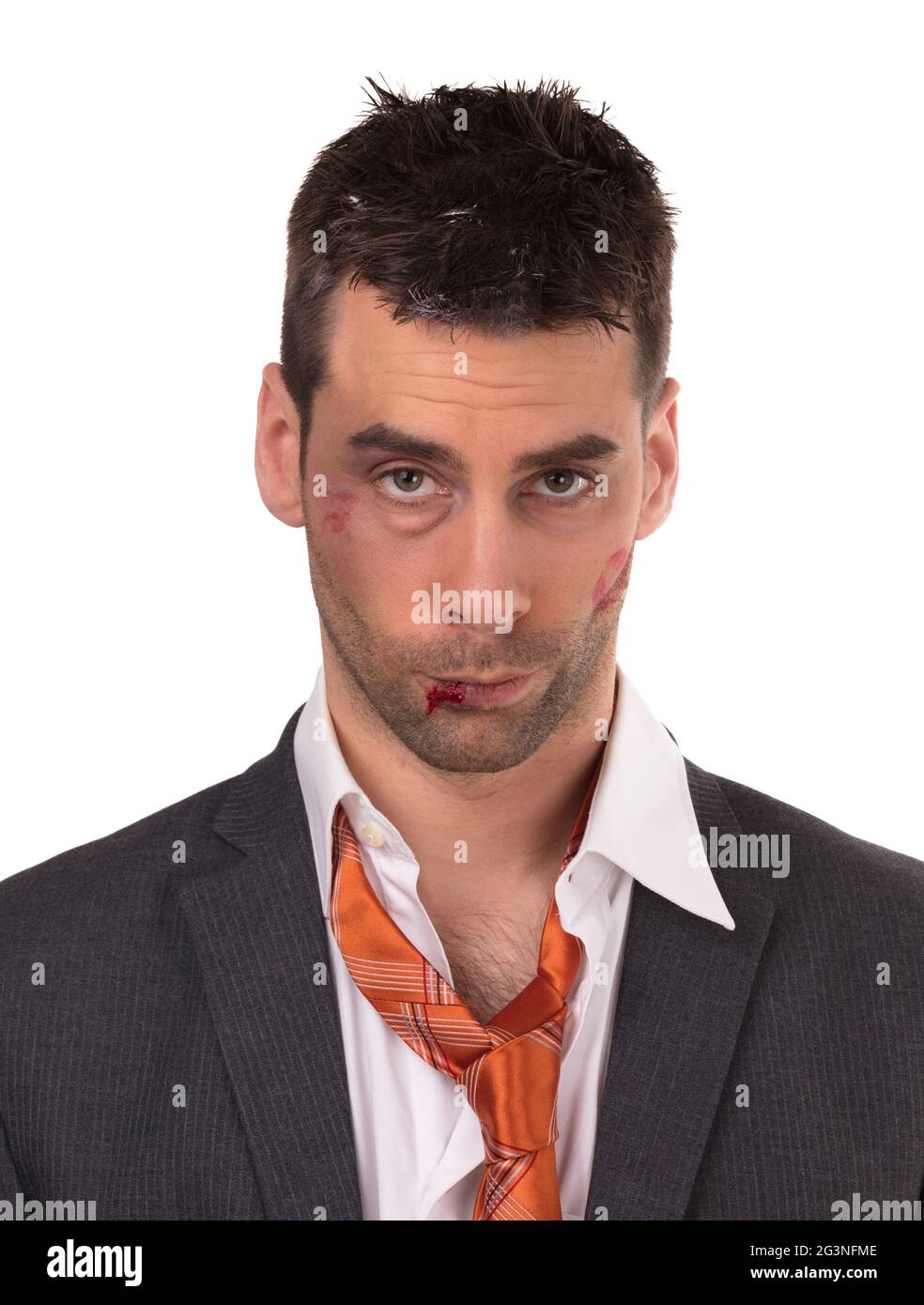 Lip bleeding hi-res stock photography and images - Alamy