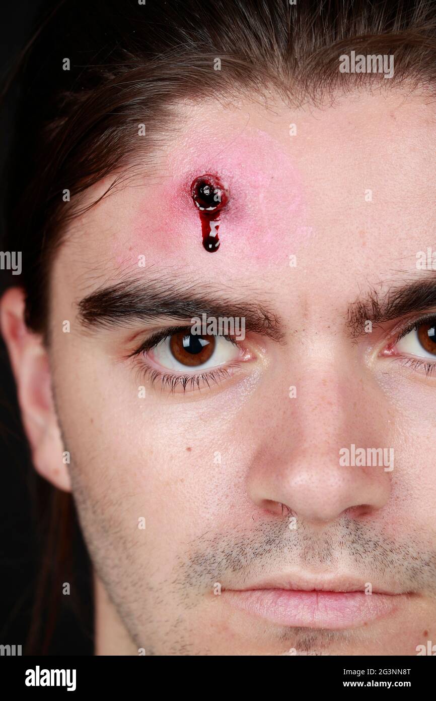 Bloody Forehead High Resolution Stock Photography and Images - Alamy