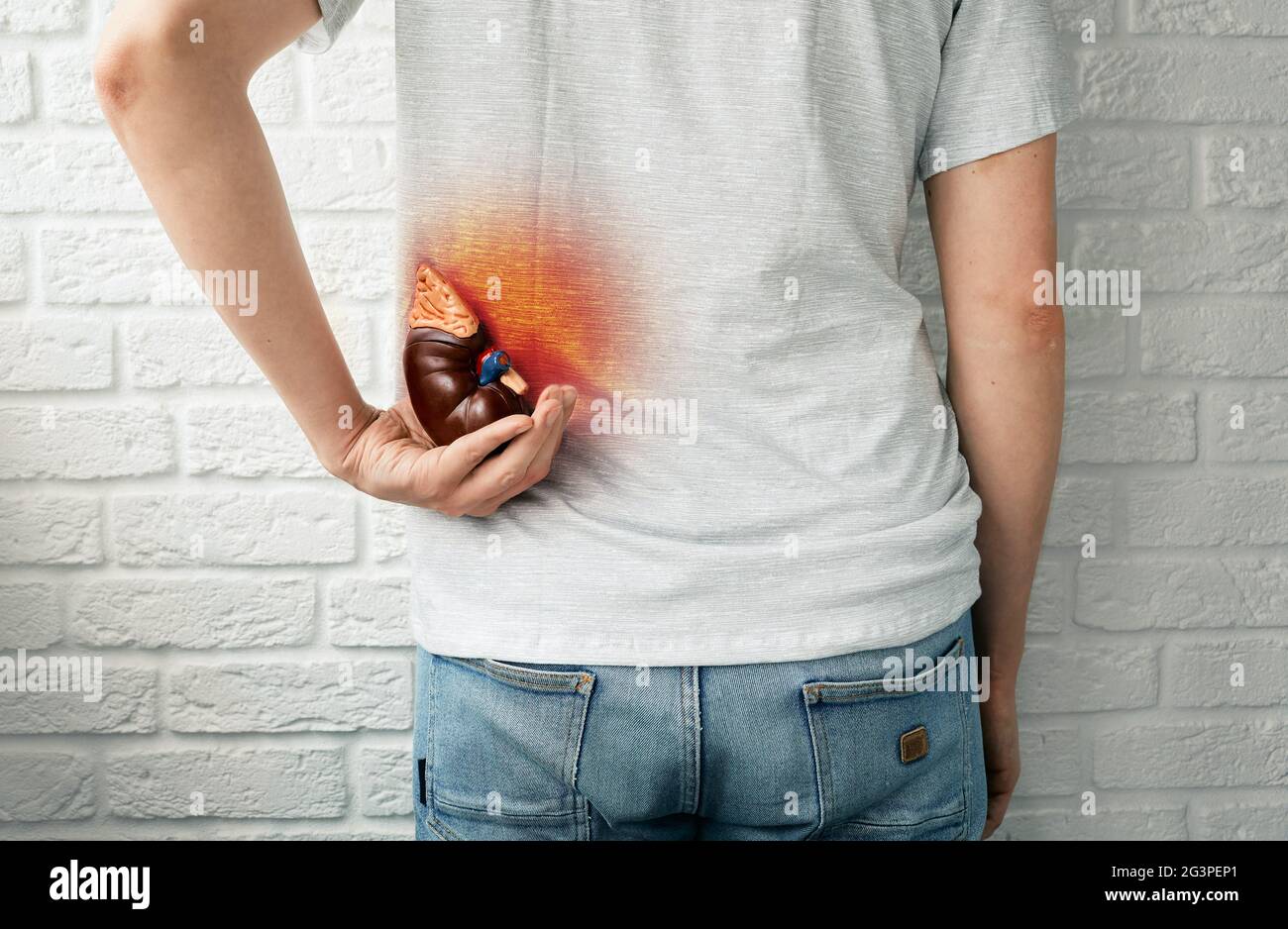 Male suffering from pain with inflammation and renal colic. Kidney ...