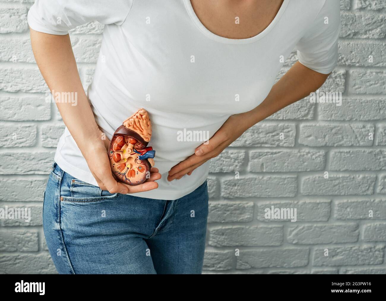 Pyelonephritis, inflammation of kidneys. Woman suffering from pain from ...