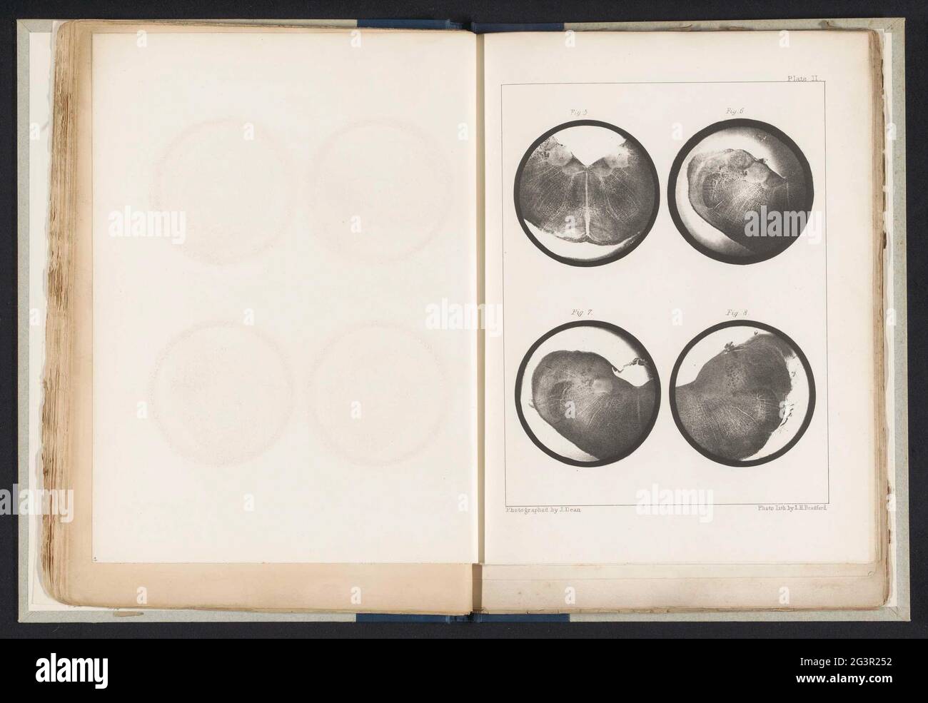 Four cross sections of a medulla oblongata from a sheep Stock Photo - Alamy