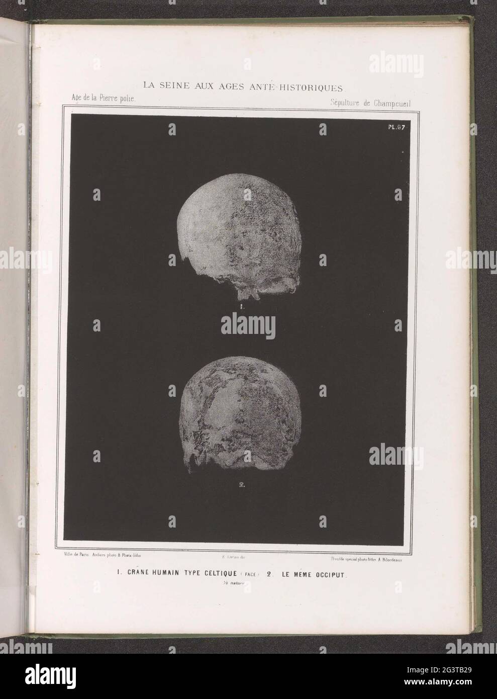 Occiput hi-res stock photography and images - Alamy