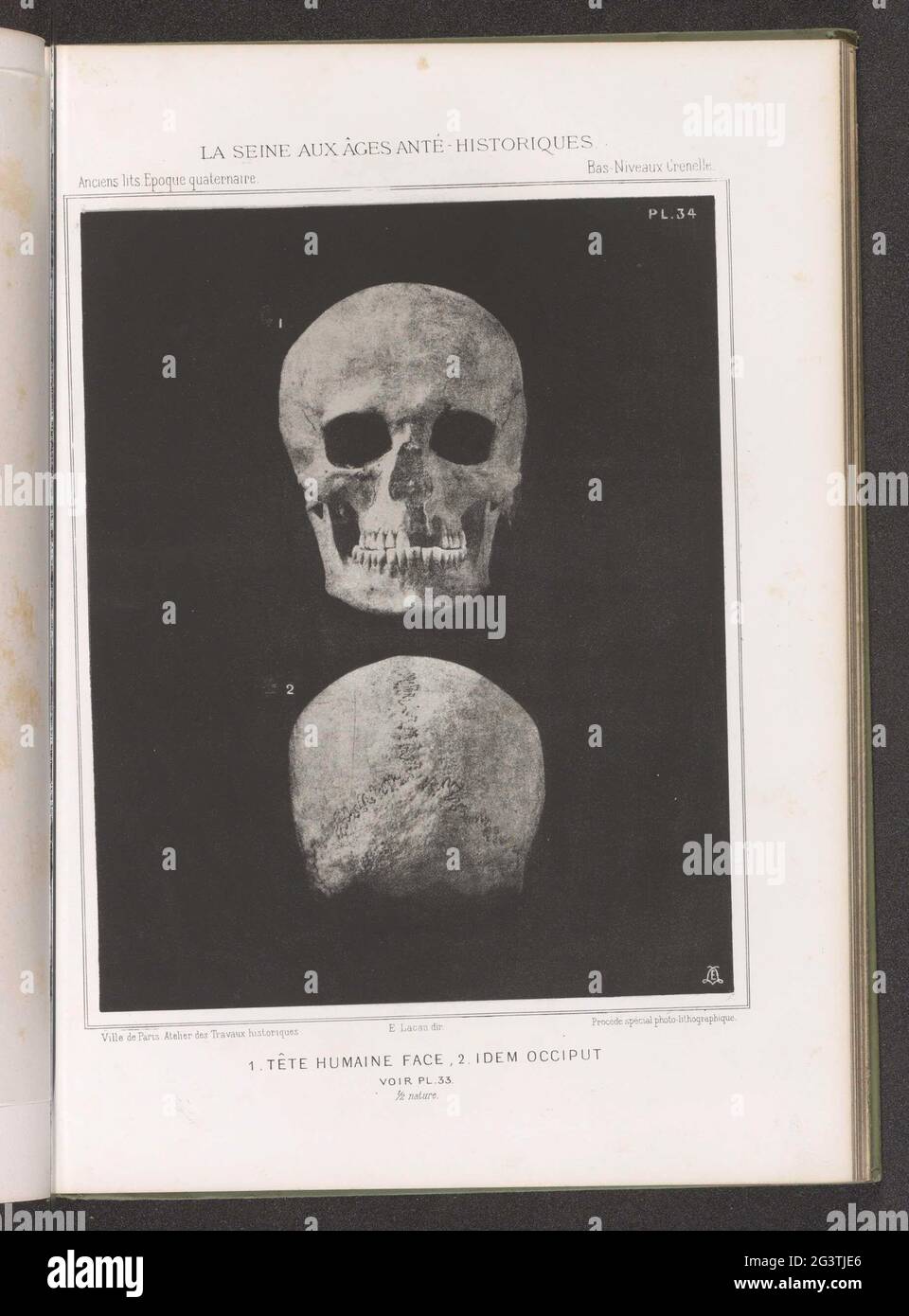 Occiput High Resolution Stock Photography and Images - Alamy