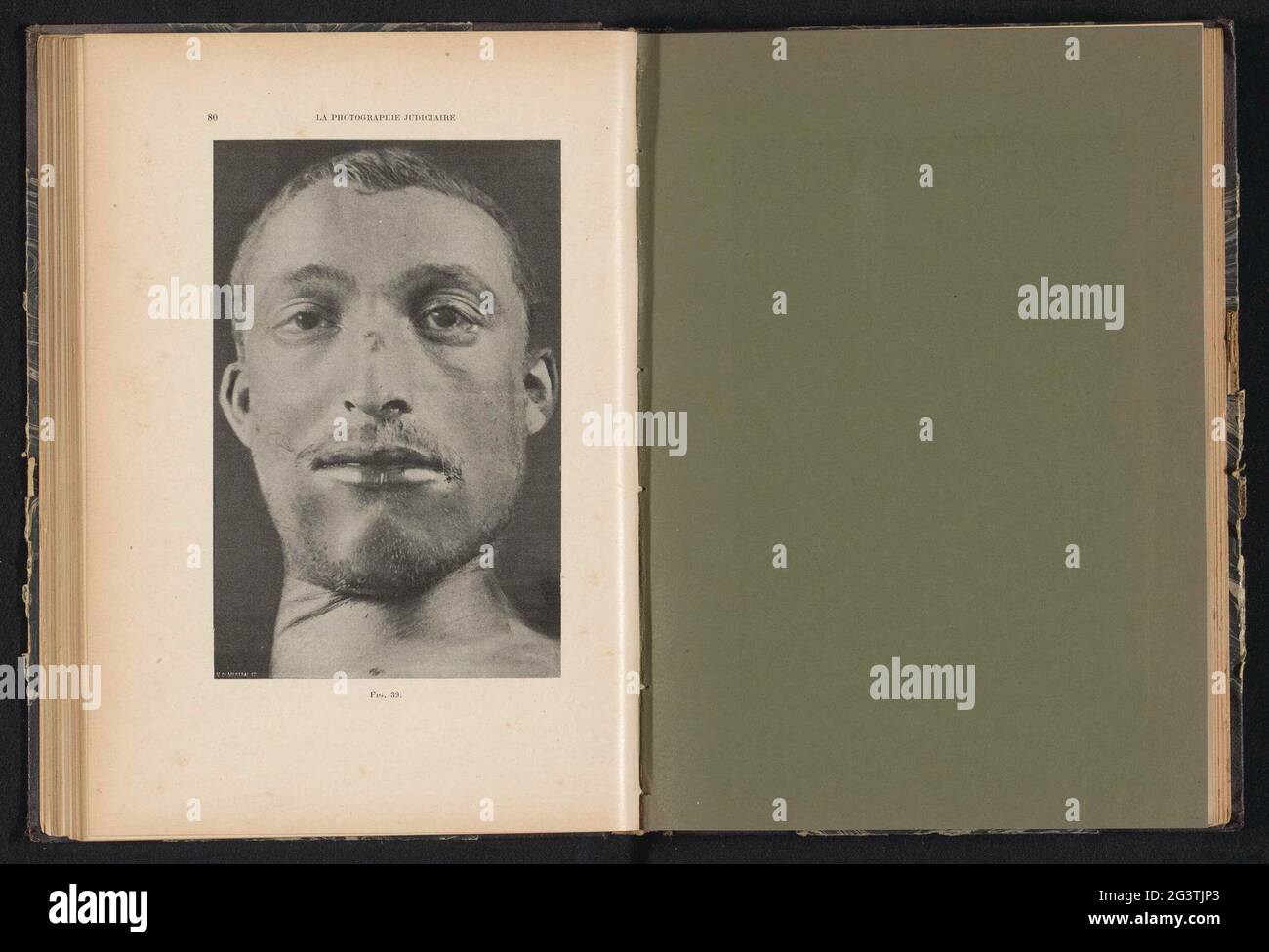 Head of a dead man Stock Photo - Alamy