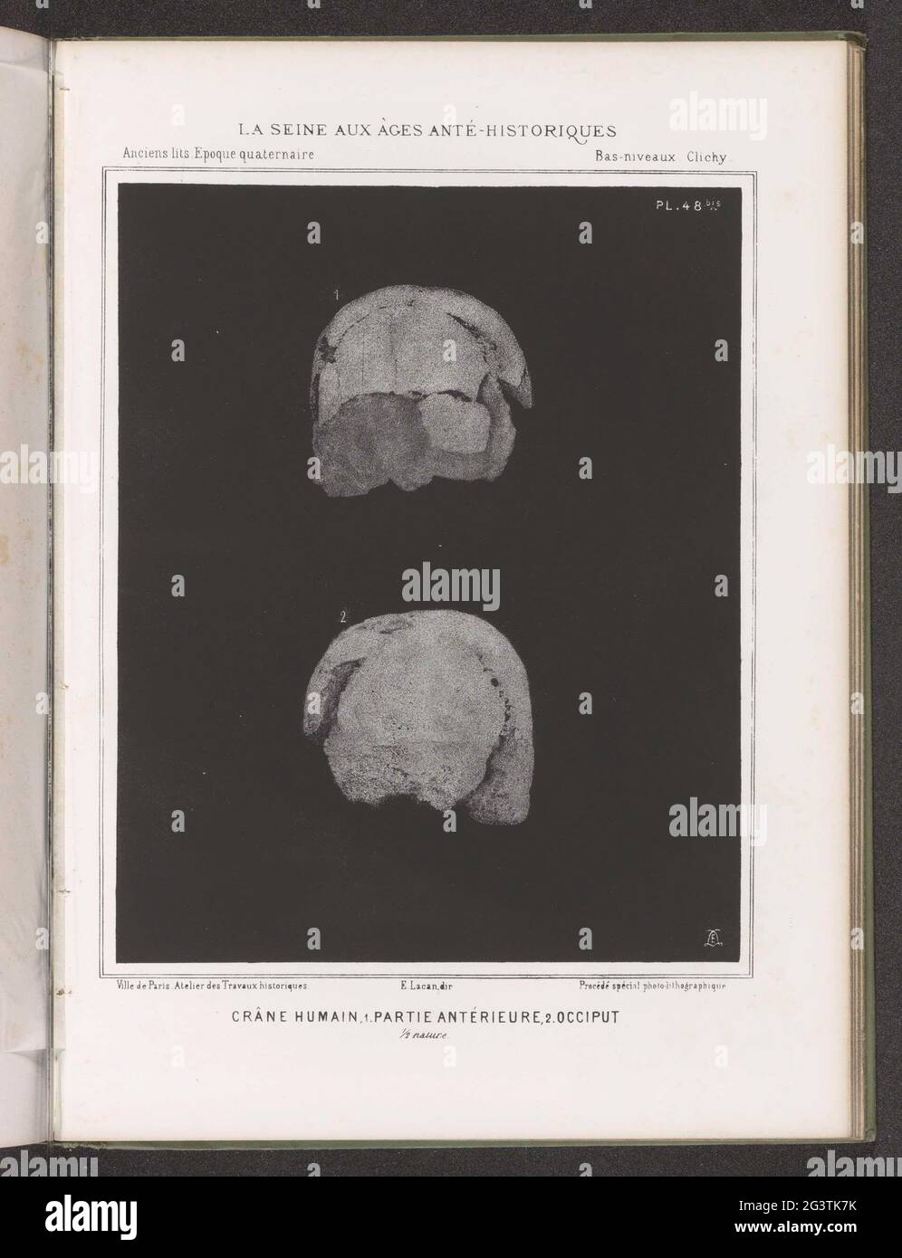Two views of a human skull, front view and rear view; Crâne Humain. 1 ...