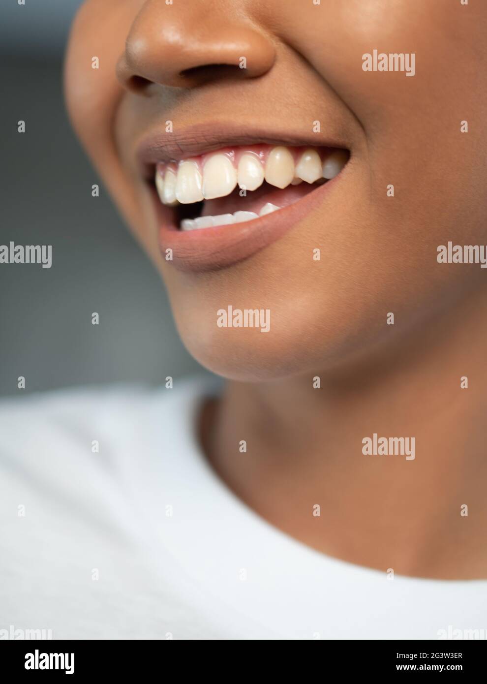 Closeup of beautiful toothy female smile Stock Photo - Alamy