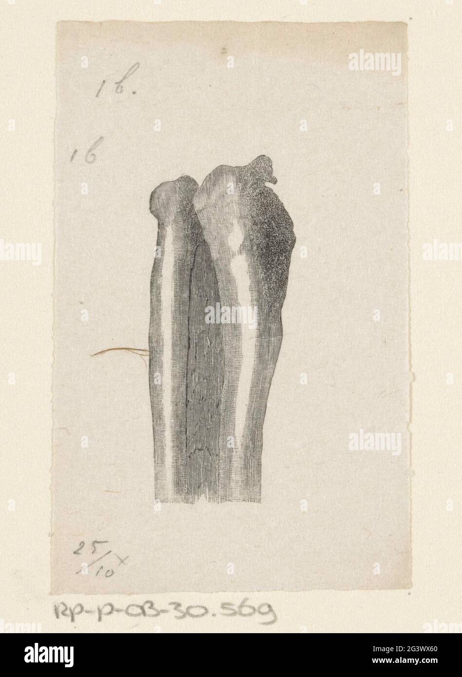Human bone with a deviation Stock Photo - Alamy