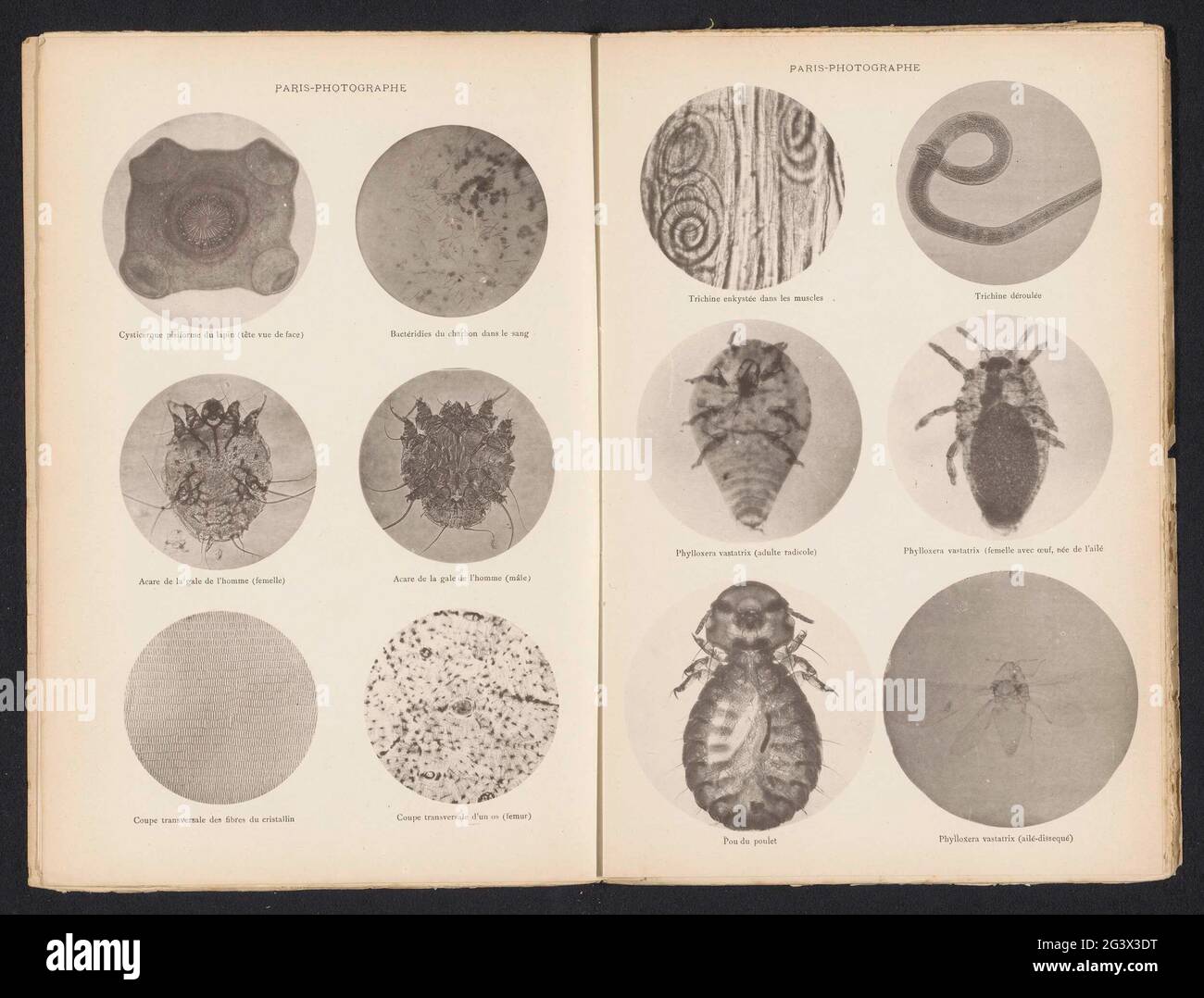Overview of microscopic magnifications. Above a cysticercus and a ...