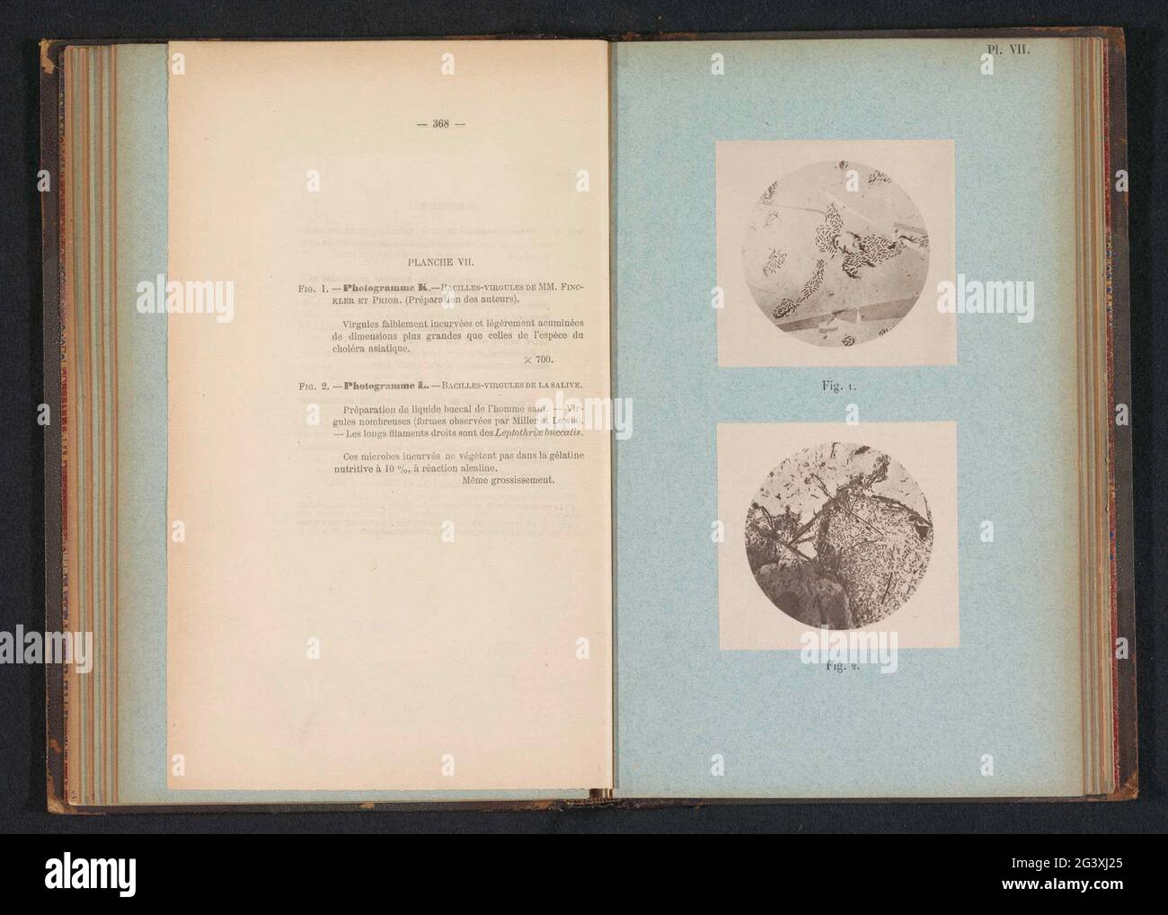 Two microscope shots of cholera Stock Photo - Alamy