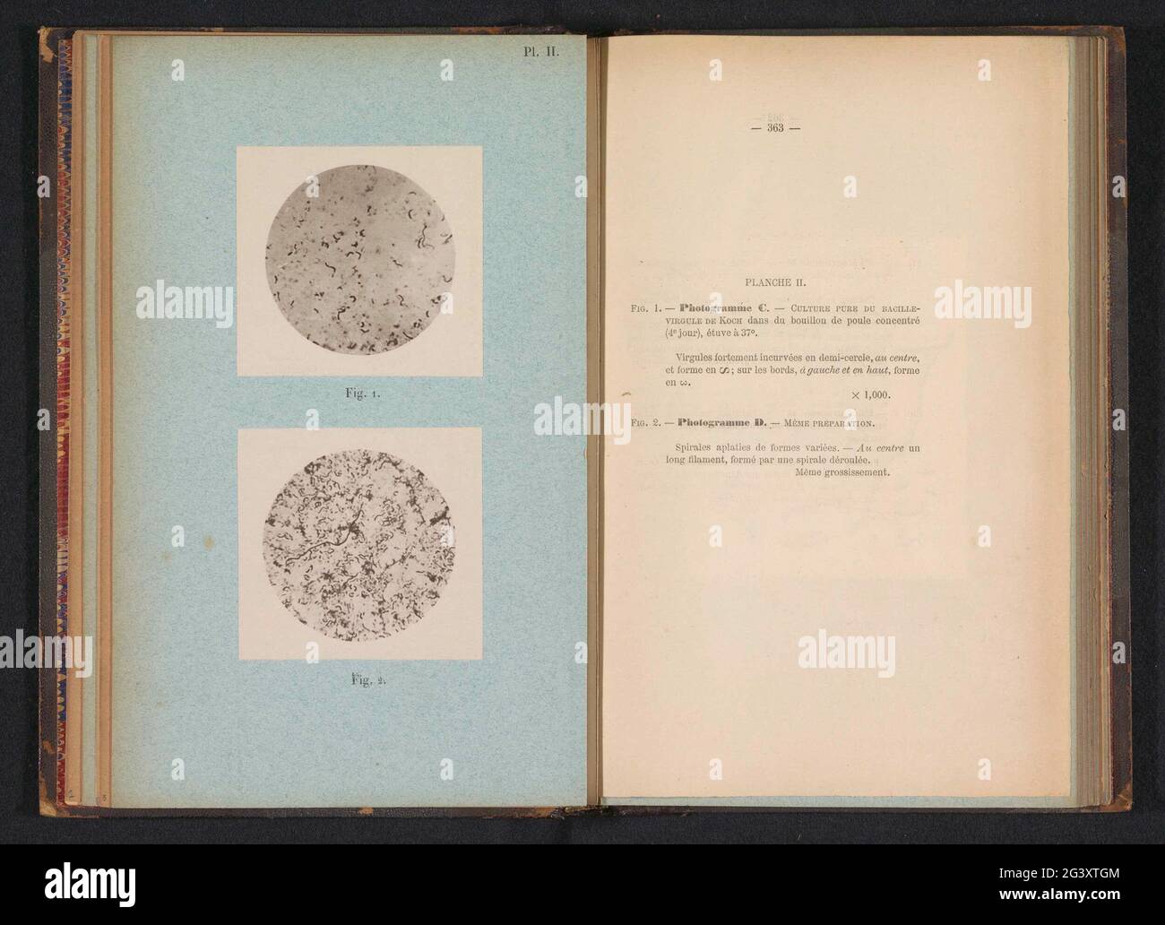 Vibrio cholerae bacteria micrograph hi-res stock photography and images ...