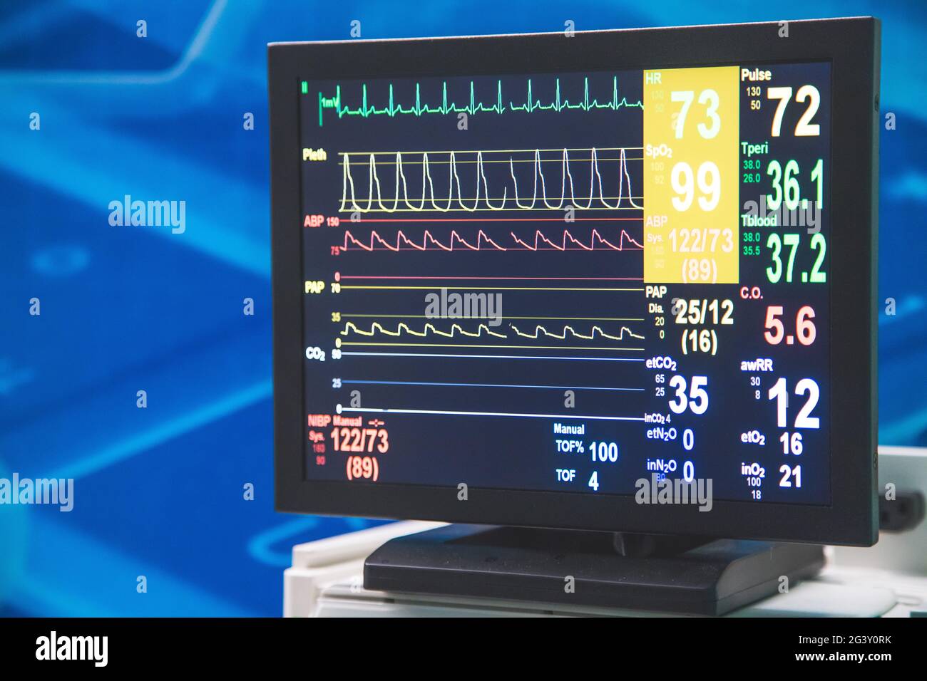 Monitoring of patientâ€™s condition and vital signs with a monitor in ...