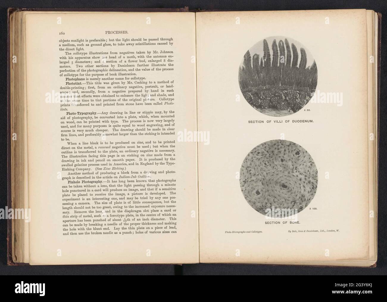 Section of villi of duodenum; Section of bone Stock Photo - Alamy