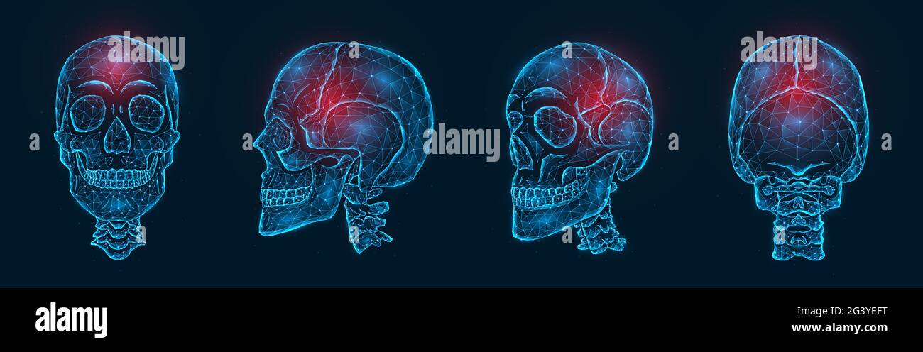 Pain, injury or inflammation of the skull bones polygonal vector ...