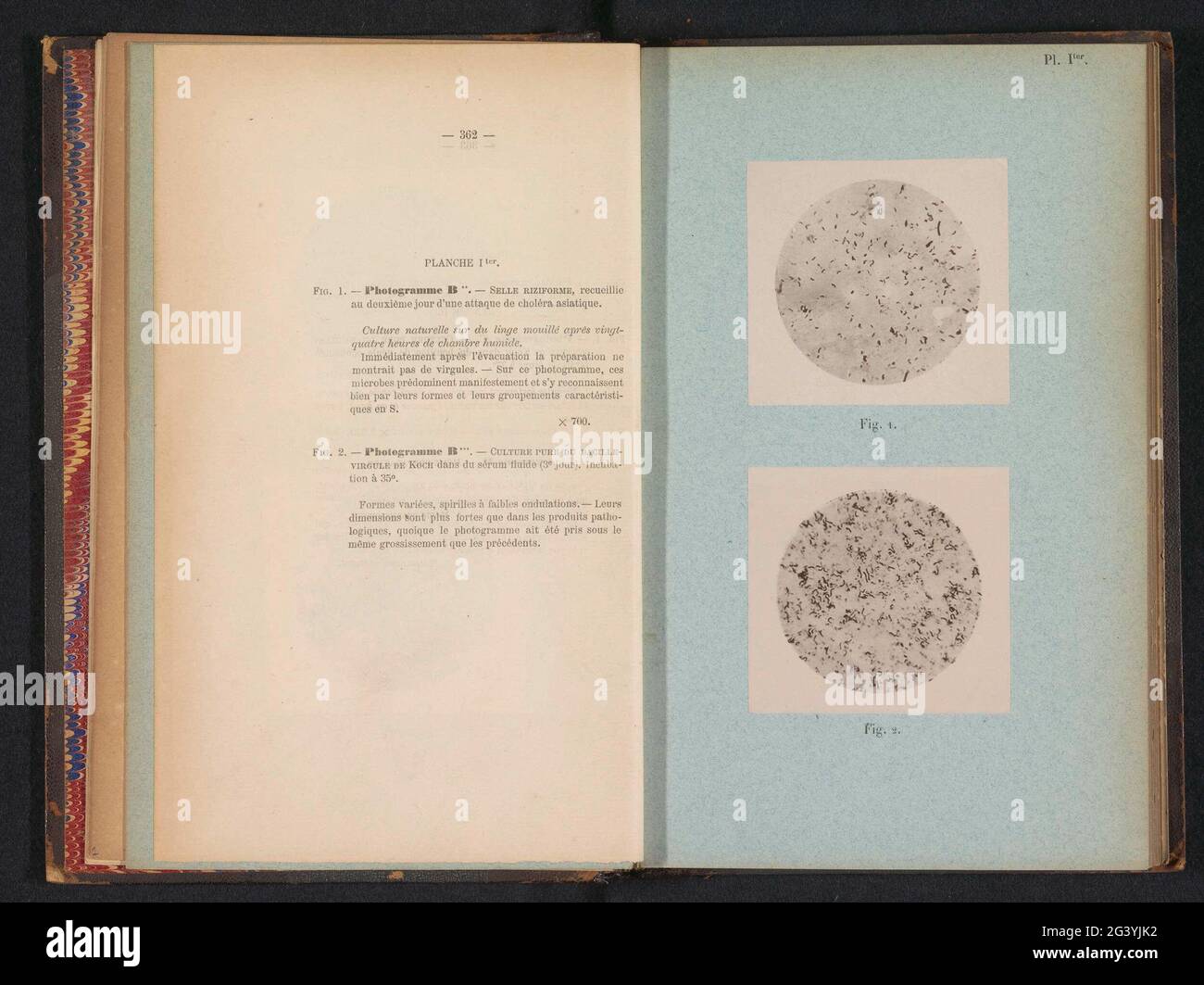 Two microscope shots of cholera Stock Photo - Alamy