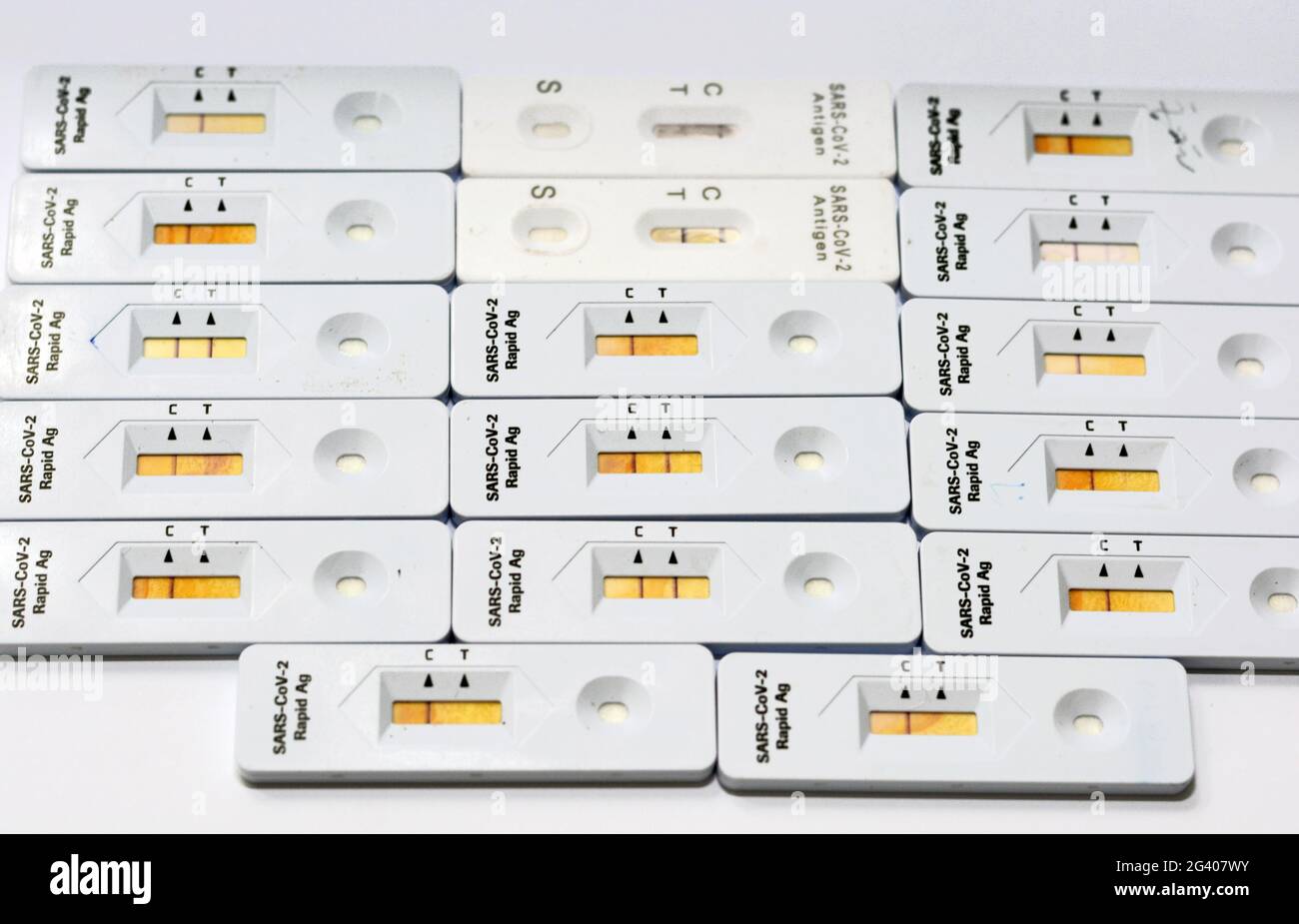 Collection of positive and negative results of SARS-CoV-2 Rapid Antigen ...