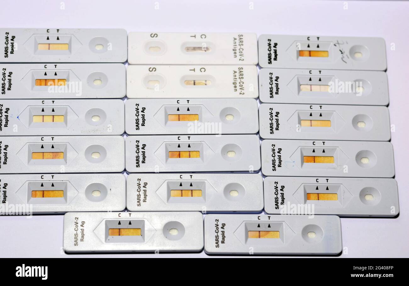 Collection of positive and negative results of SARS-CoV-2 Rapid Antigen ...