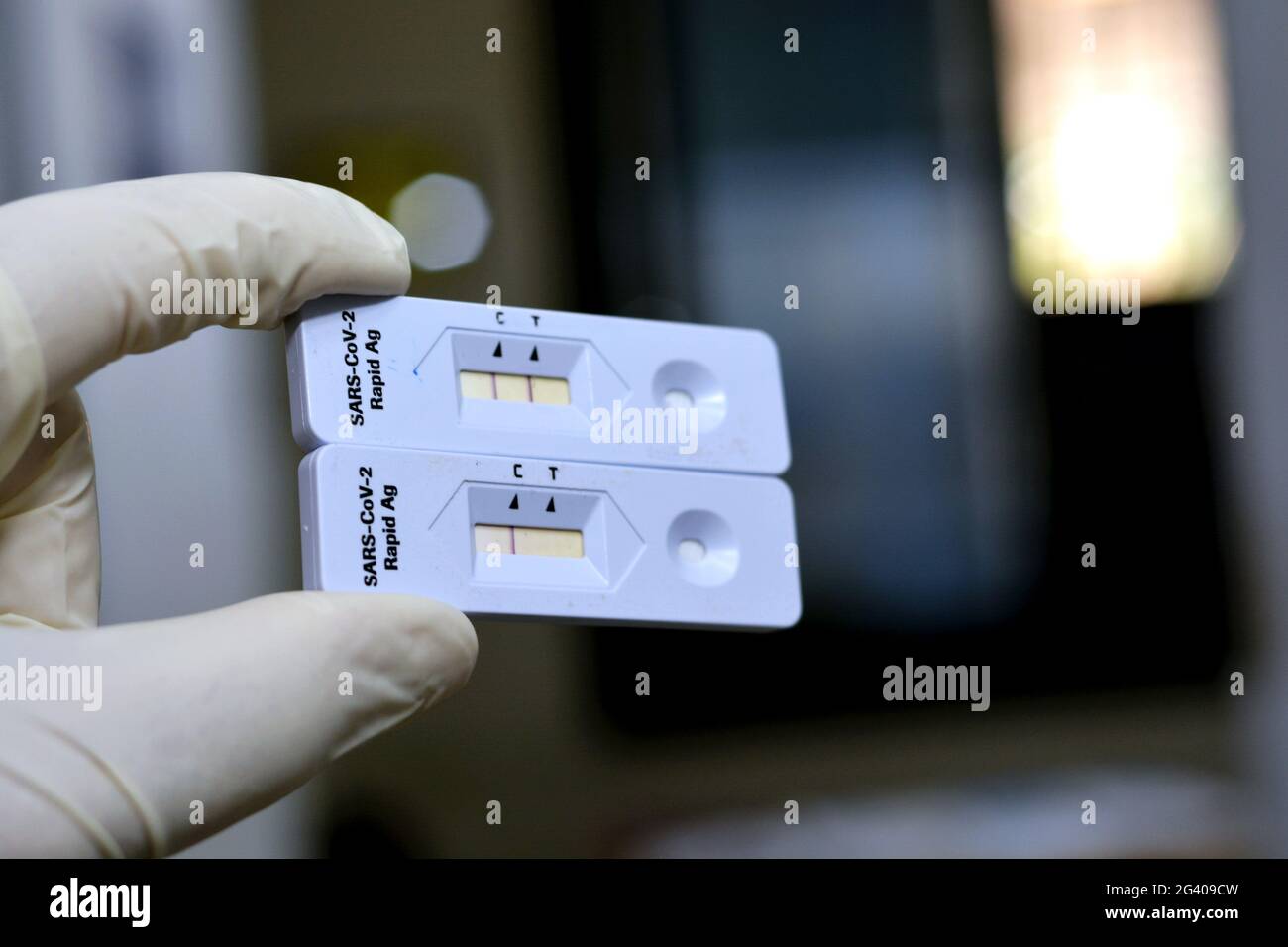 Positive and negative results of SARS-CoV-2 Rapid Antigen AG test done ...