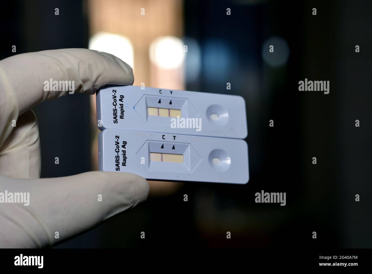 Positive and negative results of SARS-CoV-2 Rapid Antigen AG test done ...