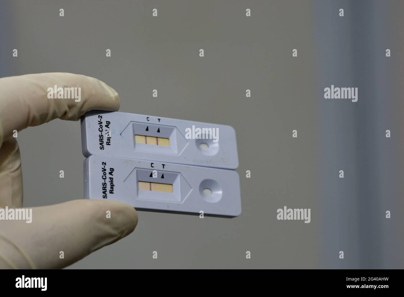 Positive and negative results of SARS-CoV-2 Rapid Antigen AG test done ...