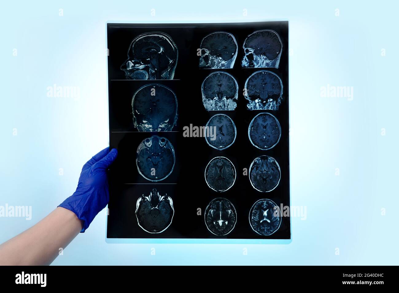 hand in glove holding MRI brain scan or magnetic resonance image ...