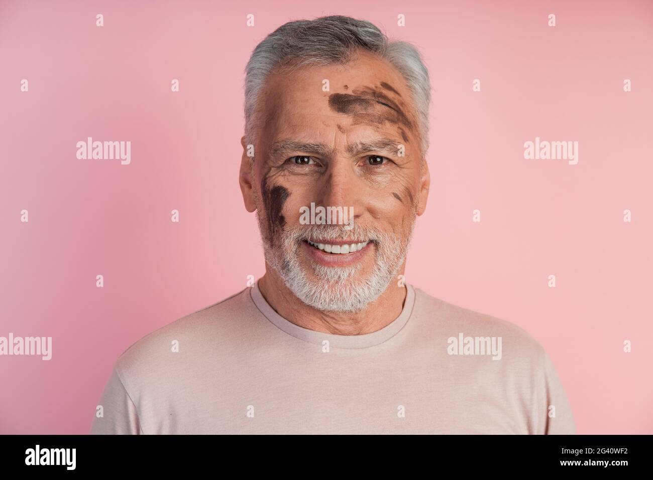 Greasy looking face hi-res stock photography and images - Alamy