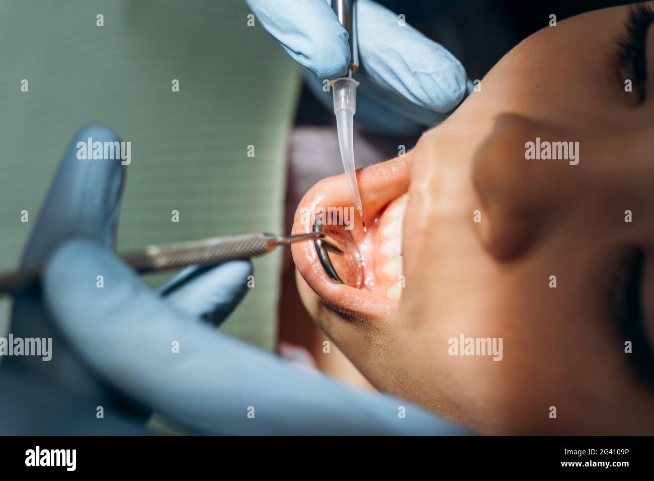 Close up view, the dentist examines the patient's lower jaw. The ...