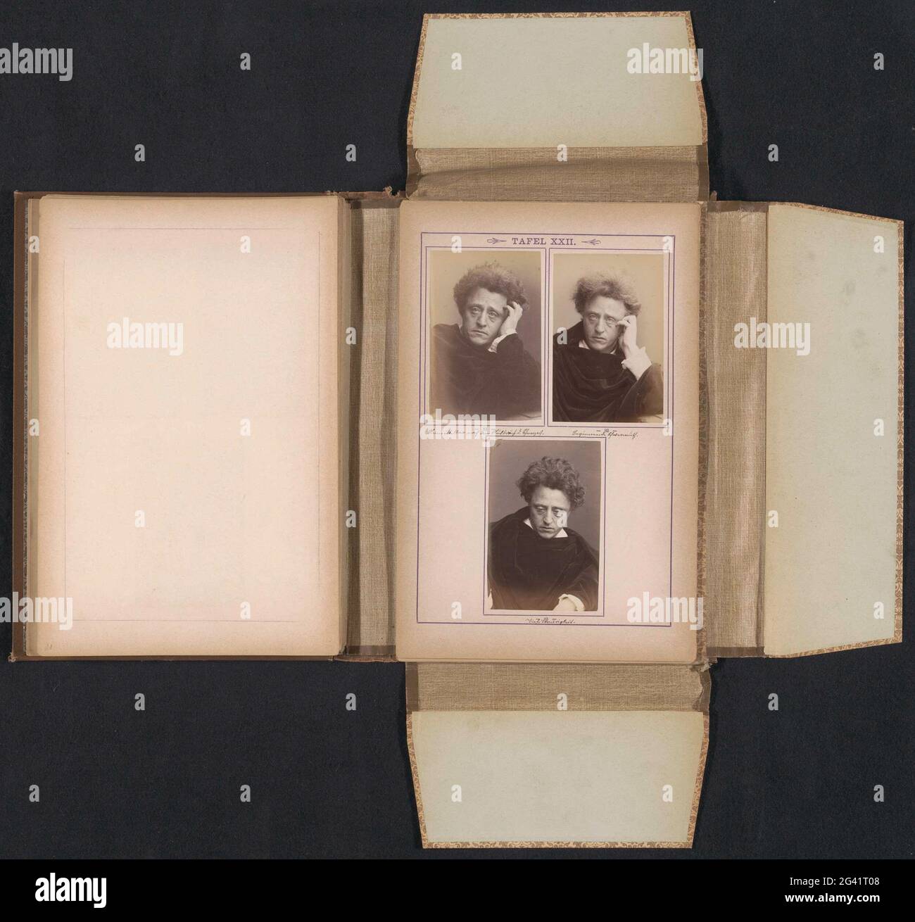 Three portraits of a man with facial expressions of pain and named ...