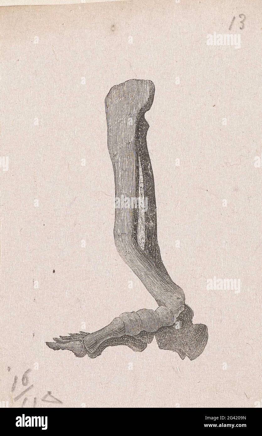 Human bone with a deviation Stock Photo - Alamy