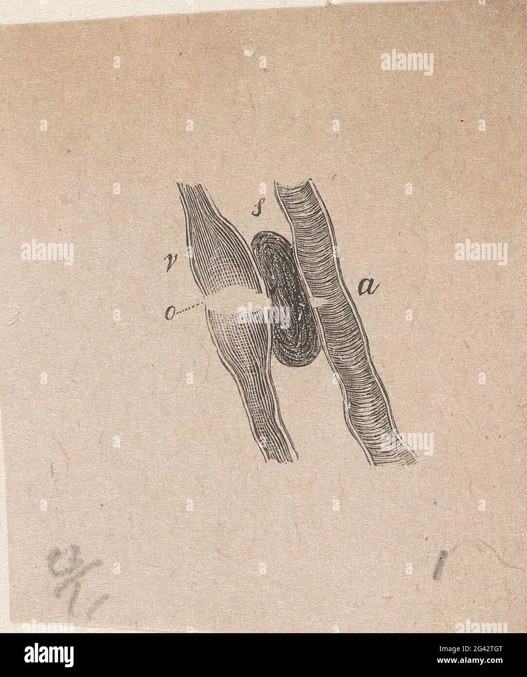 Part of the human body with a deviation Stock Photo - Alamy