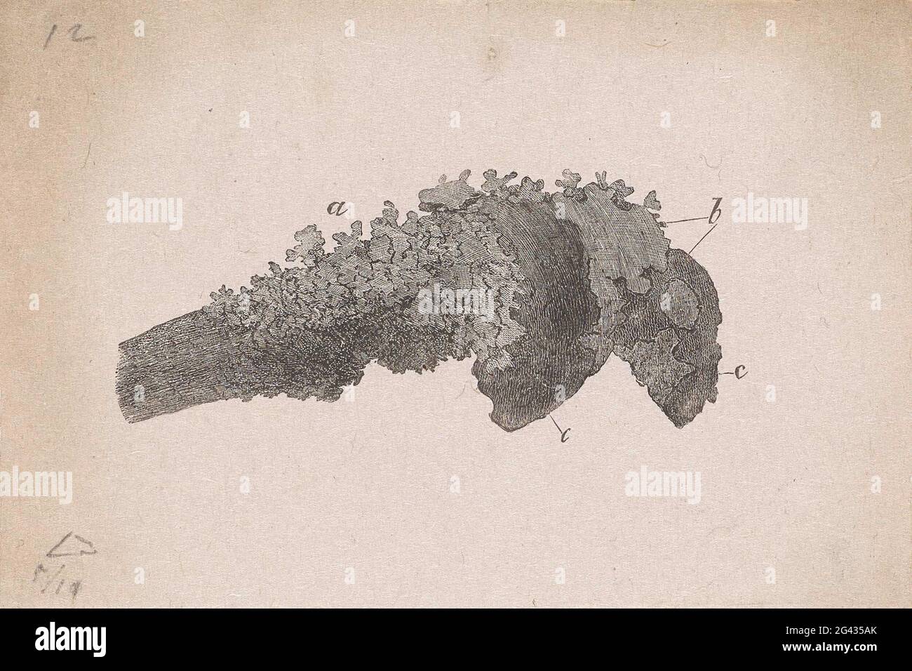 Human bone with a deviation Stock Photo - Alamy