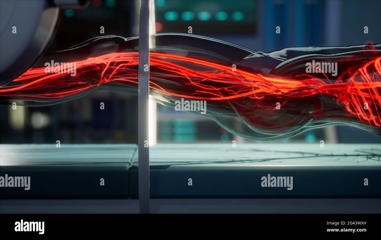 Science anatomy scan of human Blood Vessels Stock Photo - Alamy