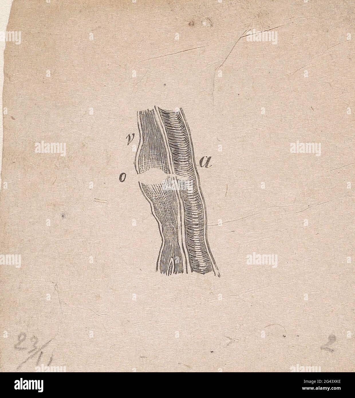 Part of the human body with a deviation Stock Photo - Alamy