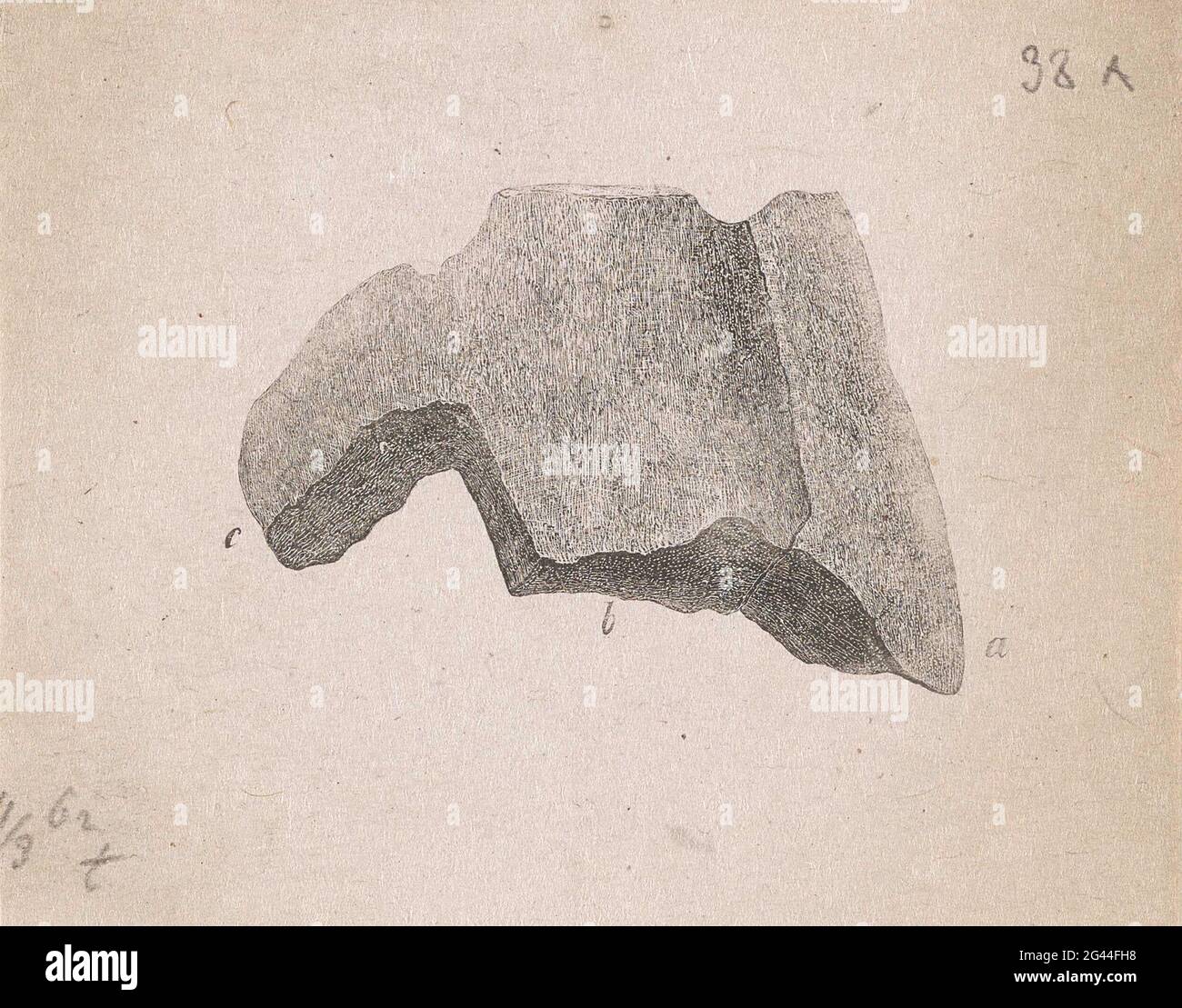 Part of the human body with a deviation Stock Photo - Alamy