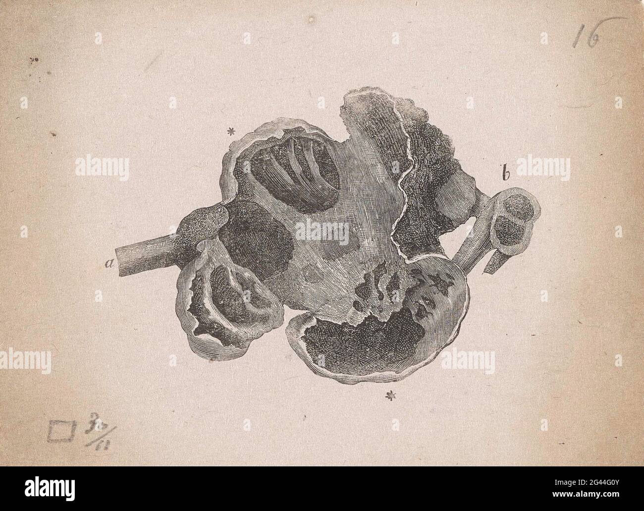 Part of the human body with a deviation Stock Photo - Alamy