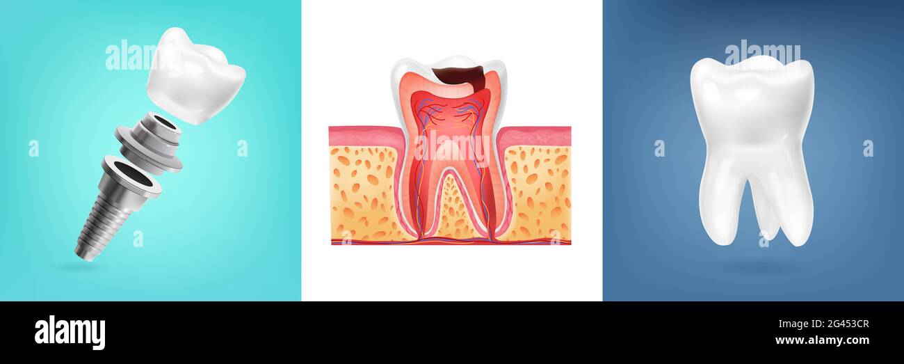 Human Canine Tooth High Resolution Stock Photography and Images - Alamy