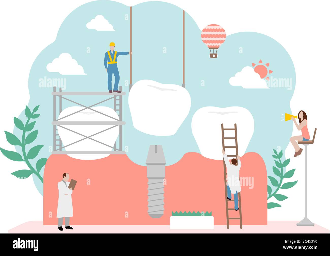 Implantation vector vectors hi-res stock photography and images - Alamy