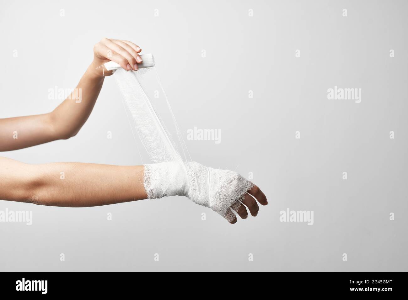 fracture arm injury medicine plaster cast close-up Stock Photo - Alamy