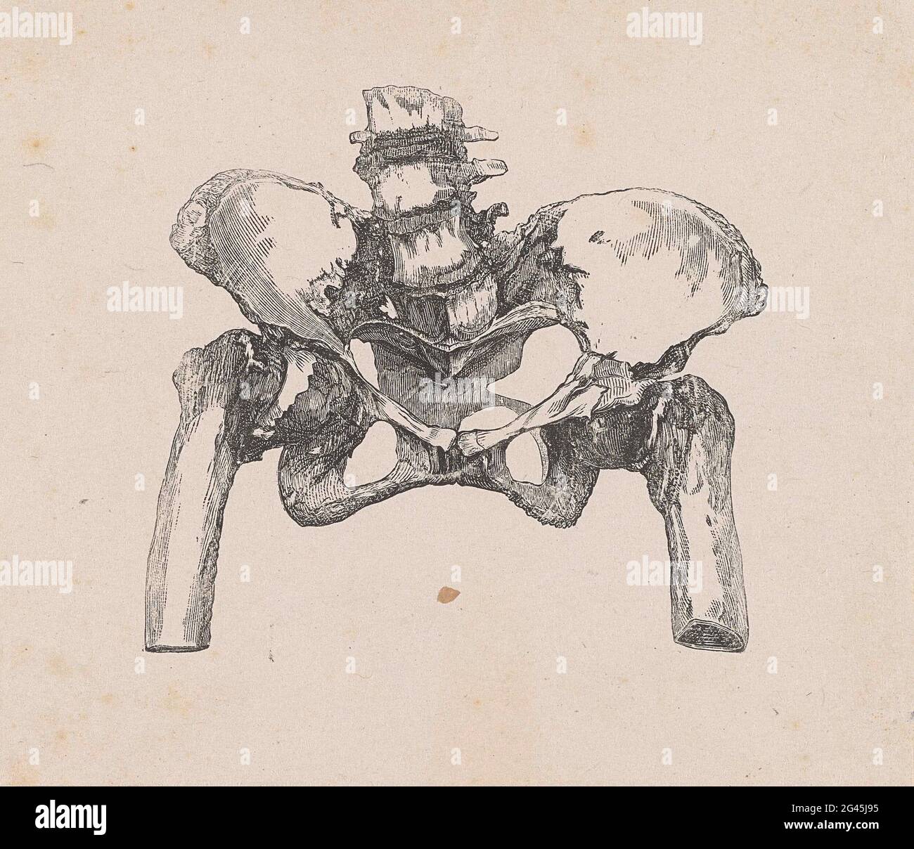 Human pelvis with a deviation Stock Photo - Alamy