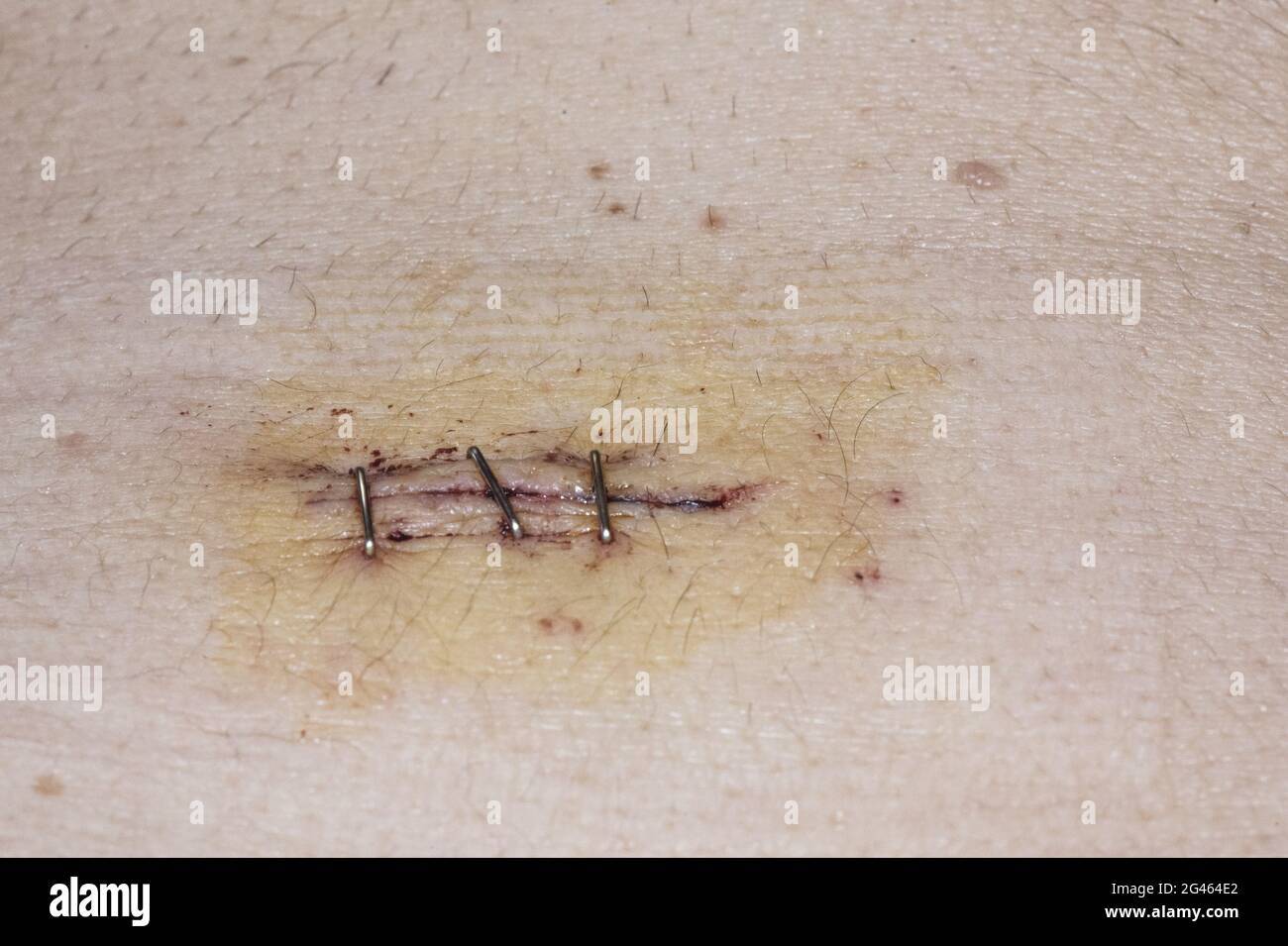 Human Belly Button Detail High Resolution Stock Photography and Images ...